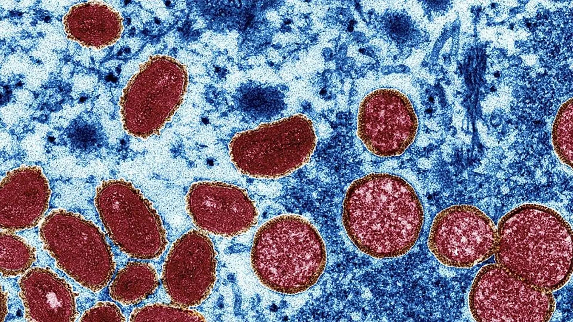 Viruela del mono: origen, cómo se contagia y cuáles son los síntomas ...