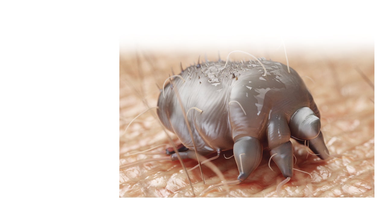 ¿Qué es la sarna y cómo se contagia? | El Diario Vasco