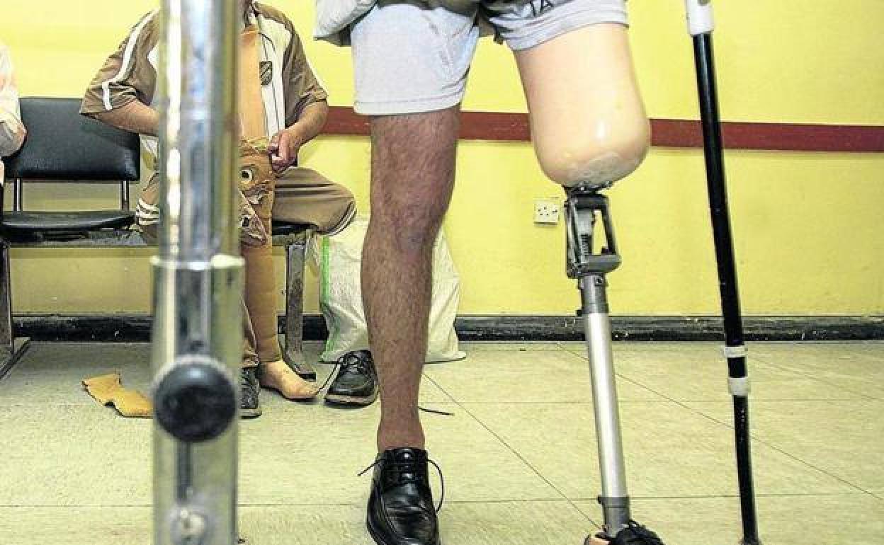 Nadie ha pasado a retirar la pierna amputada en un hospital vasco | El ...