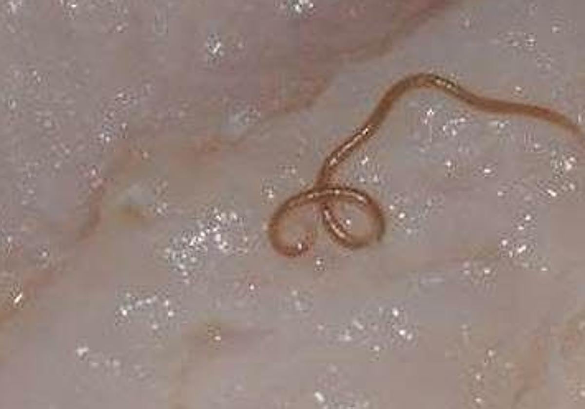 Todas las merluzas y el 20% de las anchoas tienen anisakis, según un ...