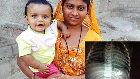 Una bebé india de seis meses se traga una navaja mientras era ...