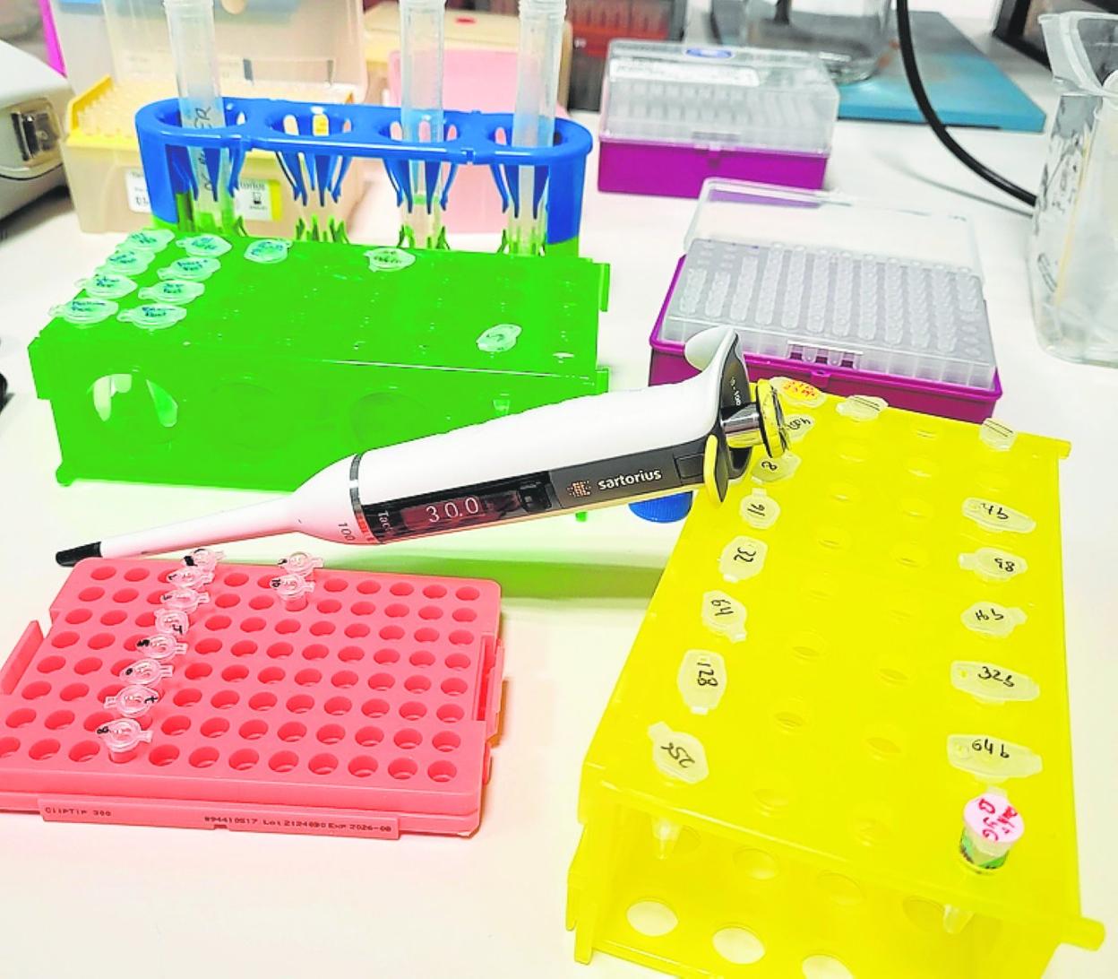 La UMU pone en marcha un avanzado laboratorio centrado en análisis de saliva | La Verdad